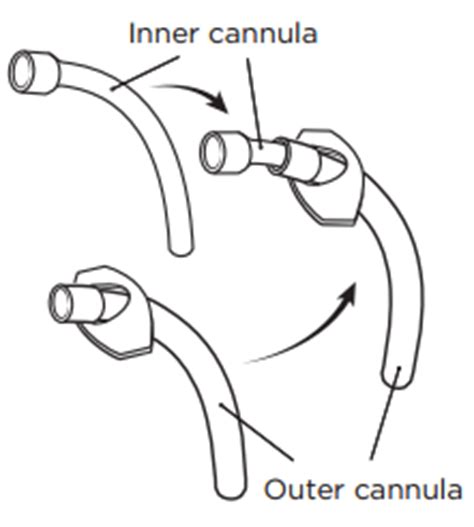 Caring For Your Tracheostomy Memorial Sloan Kettering Cancer Center