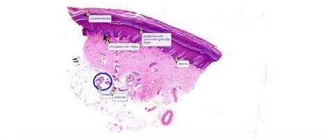 Glass Lip Histology Slide Thickness 12mm At Rs 800piece In Noida