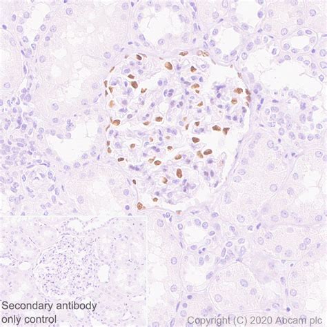 重组wilms Tumor Protein抗体[epr23963 116] Ab267377 Abcam