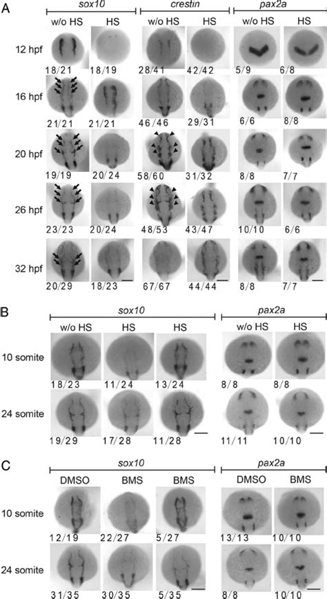 Igf Signaling Is Important For Neural Crest Cell Differentiation And Or Download Scientific