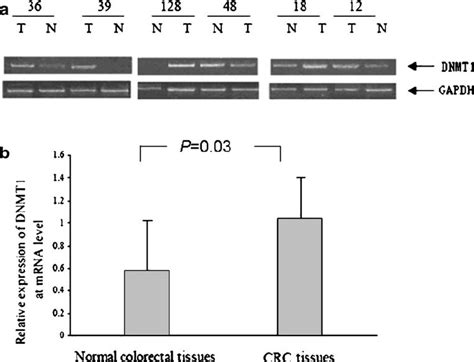Reverse Transcriptase Polymerase Chain Reaction Rt Pcr Analysis Of Download Scientific