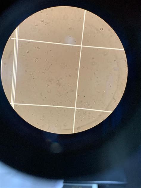 Solved Im Confused With Counting Cells Using Hemocytometer