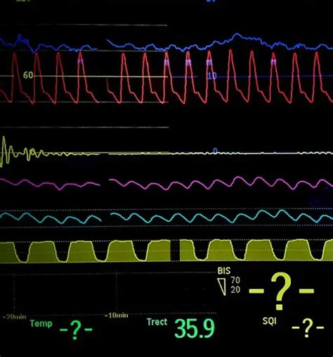 Will End Tidal Co2 Monitoring Become A Reality In Diving Indepth