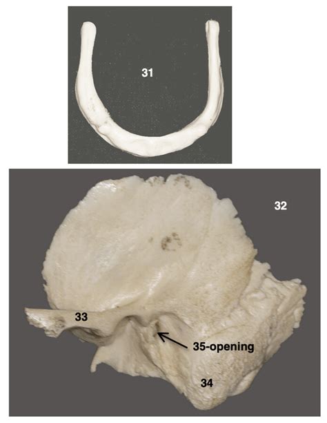 Temporal Bone Diagram Quizlet