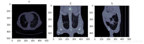 【simpleitk】胸部ct数据3d Space归一化，以及3d Plotsimpleitk处理ct图像 Csdn博客
