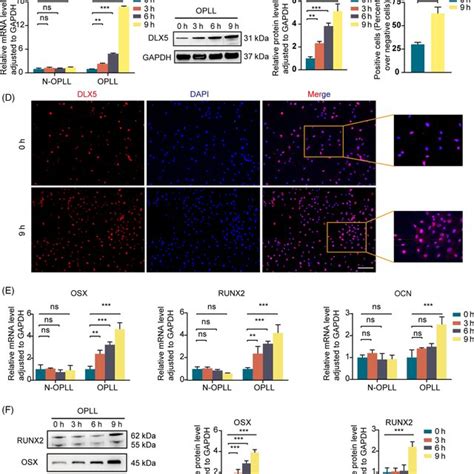 Cyclic Stretch Induced Dlx5 Expression And Osteogenic Differentiation