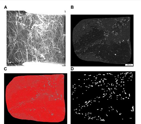 Figure 1 From A Tissue Engineered 3d Printed Calcium Alkali Phosphate Bioceramic Bone Graft