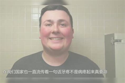 蛀牙真是虫子吗3D动画演示全过程网友称看着都疼 演示 全过程 动画