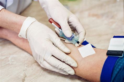 Can Synthetic Aperture Radar Sar Improve Earth Observation