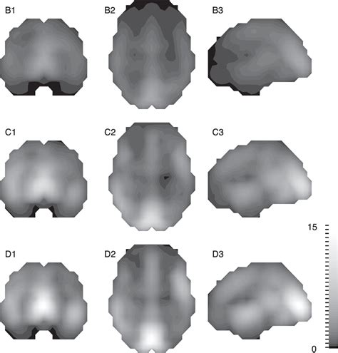 Figure 6 From A Solution To The Dynamical Inverse Problem Of Eeg