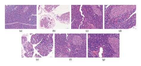 Pathological Examination Of Rat Pancreas He × 400 Download