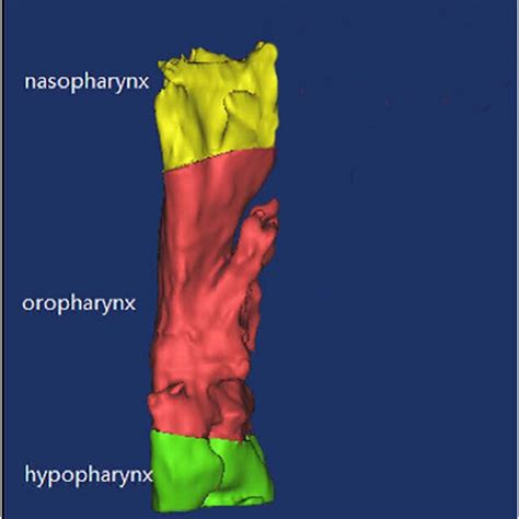 Upper Airway Segmentation With Mimics160 Software Download