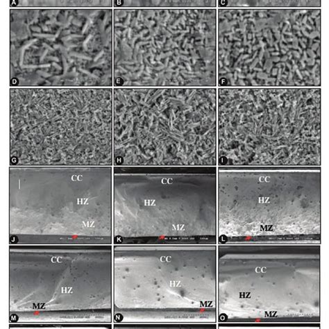Scanning Electron Microscope Photomicrographs Indicated Grain Size And Download Scientific