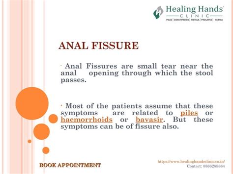 How Can You Deal With Anal Fissures Ppt