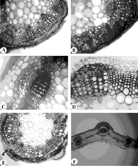 Cross Section Of Stems A Radial Chain Pore Solitary Vessel Download Scientific Diagram
