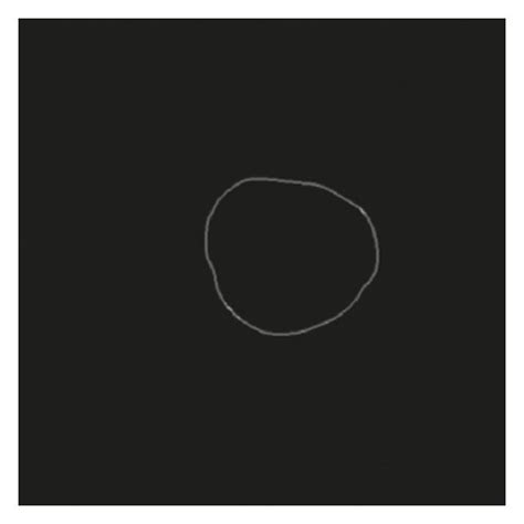 Lumen Segmentation Steps A Original Image In Cartesian Coordinates Download Scientific