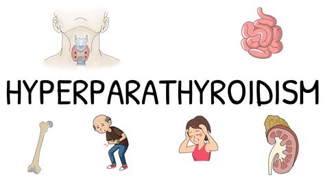 Hyperparathyroidism Primary Secondary And Tertiary Simple And Easy To Understand Youtube