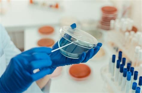 Microbial Fermentation Services Cdmo Boc Sciences