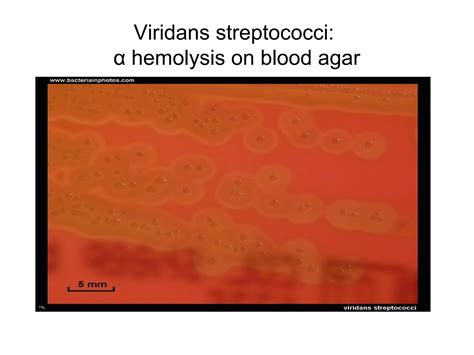 Staphylococcus Streptococcus Bacteriological Diagnosis Ii Ppt