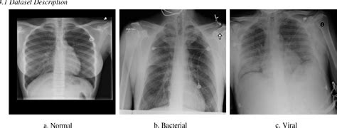 Figure 1 From Deep Learning Algorithm For Real Time Disease Detection