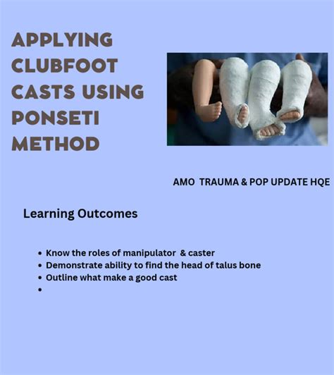 Applying Clubfoot Casts Using Ponseti Method Pdf