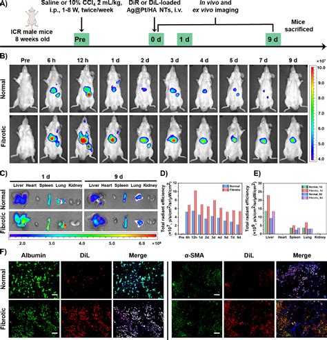 Figure From Remodeling Of The Liver Fibrosis Microenvironment Based On Nilotinib Loaded
