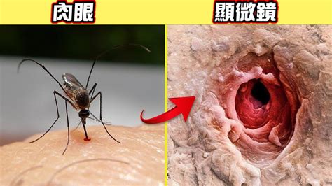 蚊子吸血被放大後是這樣的！簡直就是視覺衝擊 Youtube