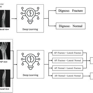 Deep Learning Ensemble Model Structure Diagram Download Scientific Diagram