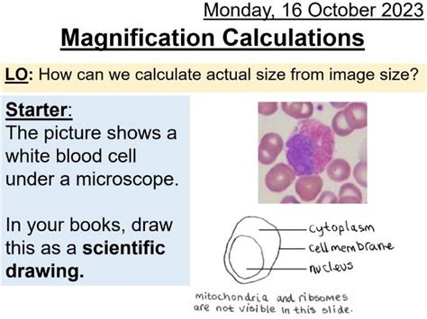 Magnification Calculations SEN LAP Teaching Resources