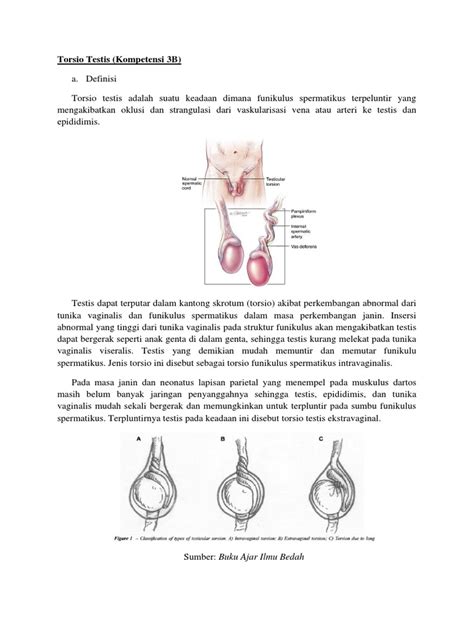 Torsio Testis Pdf