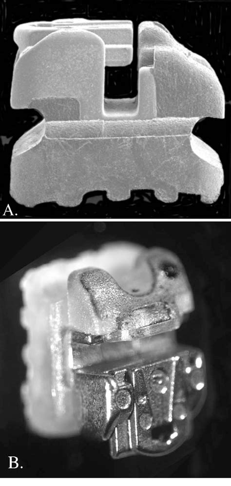 Figure 2 From Self Ligation Esthetic Brackets With Low Frictional