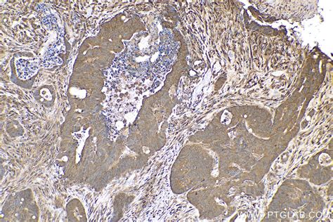 IHCeasy BAX Ready To Use IHC Kit KHC0768 Proteintech