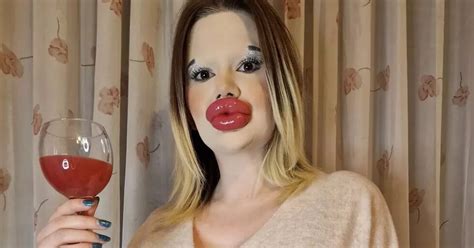 Woman With Worlds Biggest Lips Is Now Splashing Out On Her