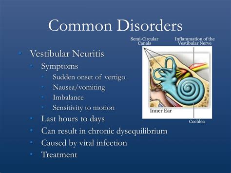 Ppt Vestibular Rehabilitation Evaluation And Treatment Strategies