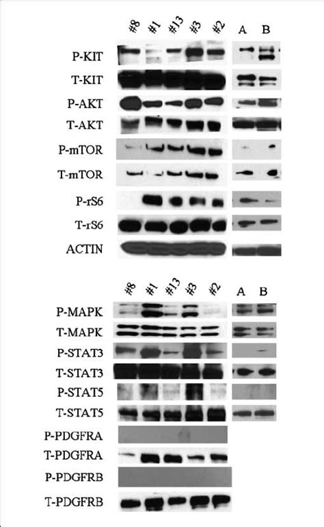 Western Blotting Of 5 Pediatric Tumors And 2 Adult Kit Exon 11 Mutant Download Scientific