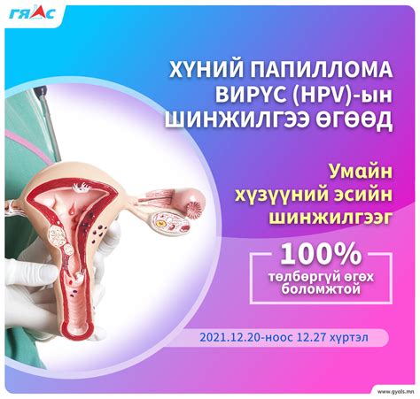 Умайн хүзүүний эсийн шинжилгээ Гялс Анагаах Ухааны Төв