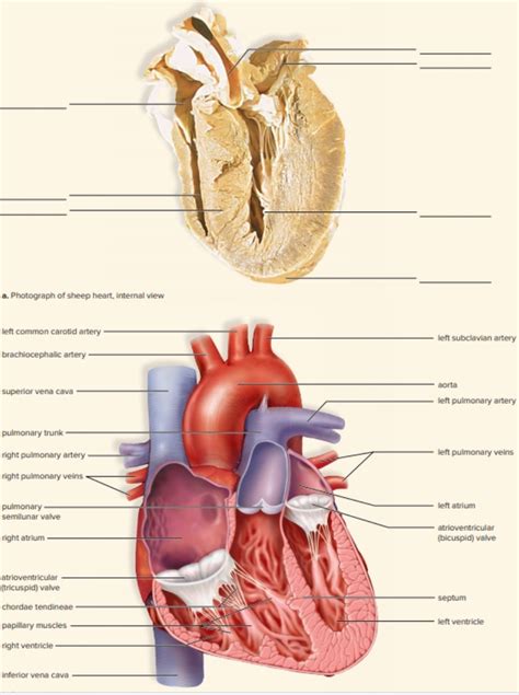 Solved A Photograph Of Sheep Heart Internal View Left