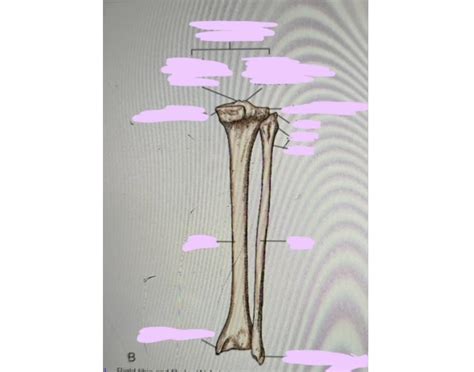 Posterior Tib Fib Quiz