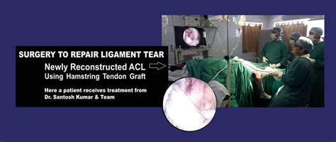 Knee Replacement Rotator Cuff Surgery Osteoarthritis Arthoscopy