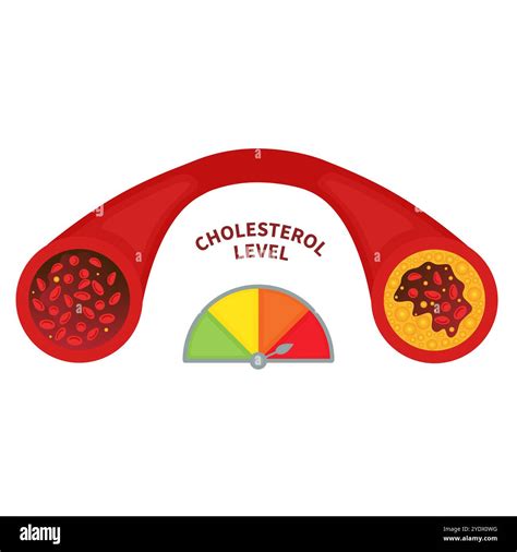 Cholesterol Level Meter Gauge With Blood Vessel Stock Vector Image