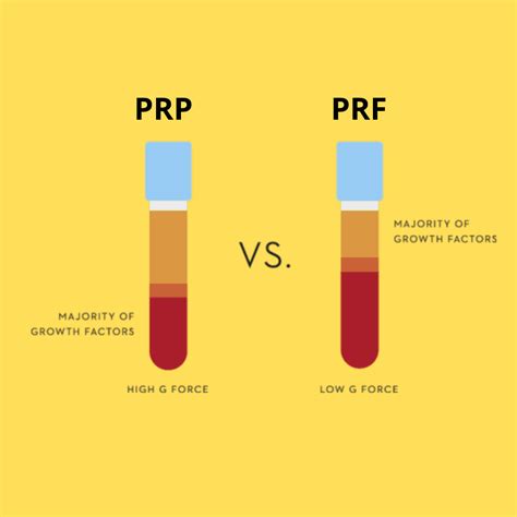 PRP Vs PRF Aesthetics And Skin Rejuvenation JUVERNE