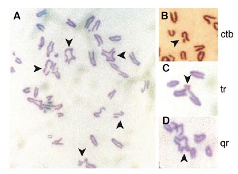 Structural Chromosomal Aberrations In Metaphase Spreads From Murine