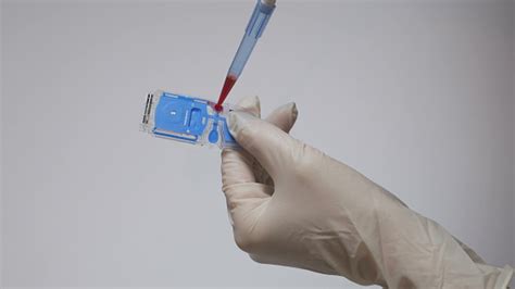 혈액 샘플 개념 의사는 생화학 적 혈액 검사를 실시하고 혈액의 포도당 수준을 측정합니다 의사는 혈액 카트리지에 혈액을 부어 분석 보기에 대한 스톡 사진 및 기타 이미지