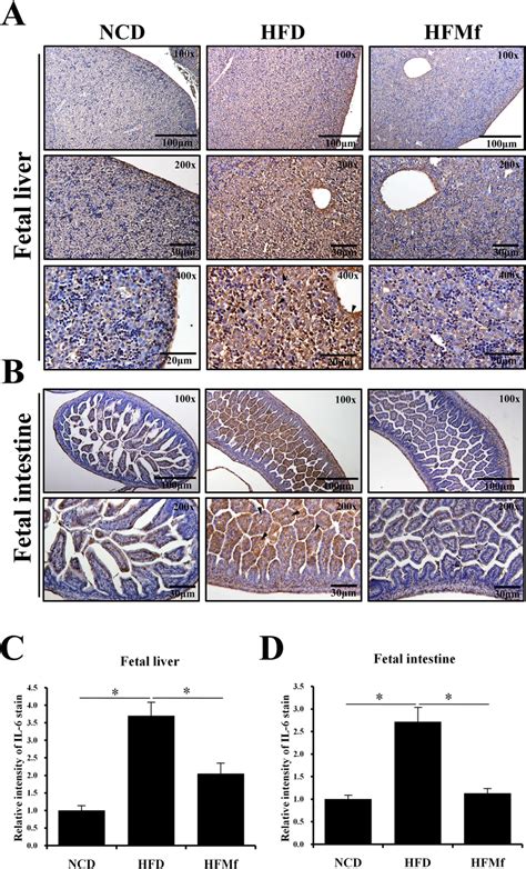 Immunohistochemical Analysis Of Il 6 Expression In The Fetal Liver And