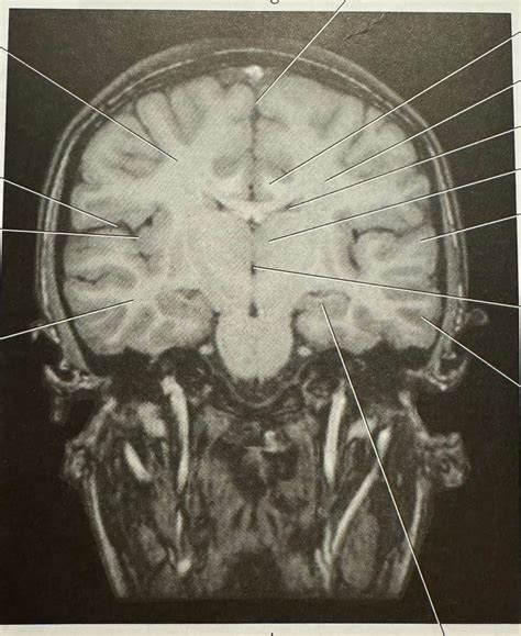 Study Guide Unit 6 Cerebrum And Diencephalon 1 Diagram Quizlet