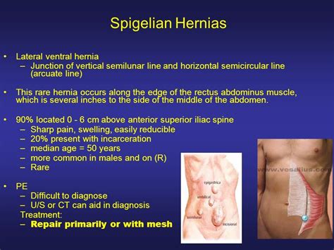 Hernias Types Symptoms And When To Seek Urgent Care
