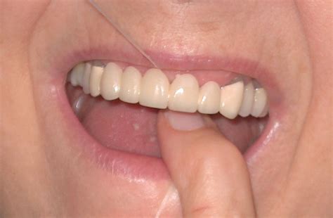 Bridge Garden Picture Bridge Floss Threader