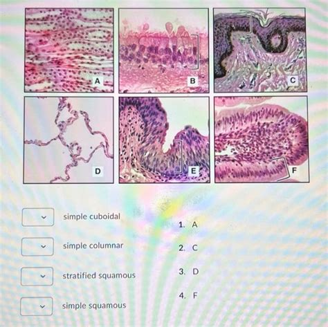 Solved Simple Cuboidal Simple Columnar Stratified Squamous