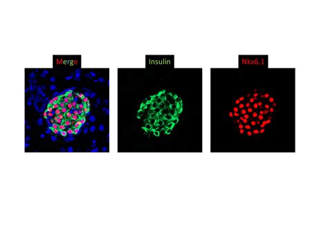 Nkx61 Antibody Bsa Free Nbp1 49672 Novus Biologicals