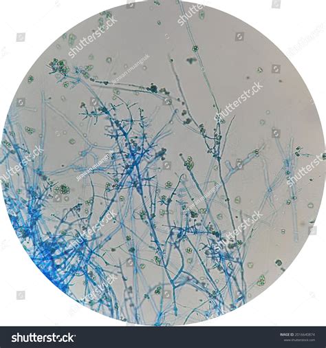 Trichoderma Harzianum Spore Hyphae Under Microscope Foto Stock